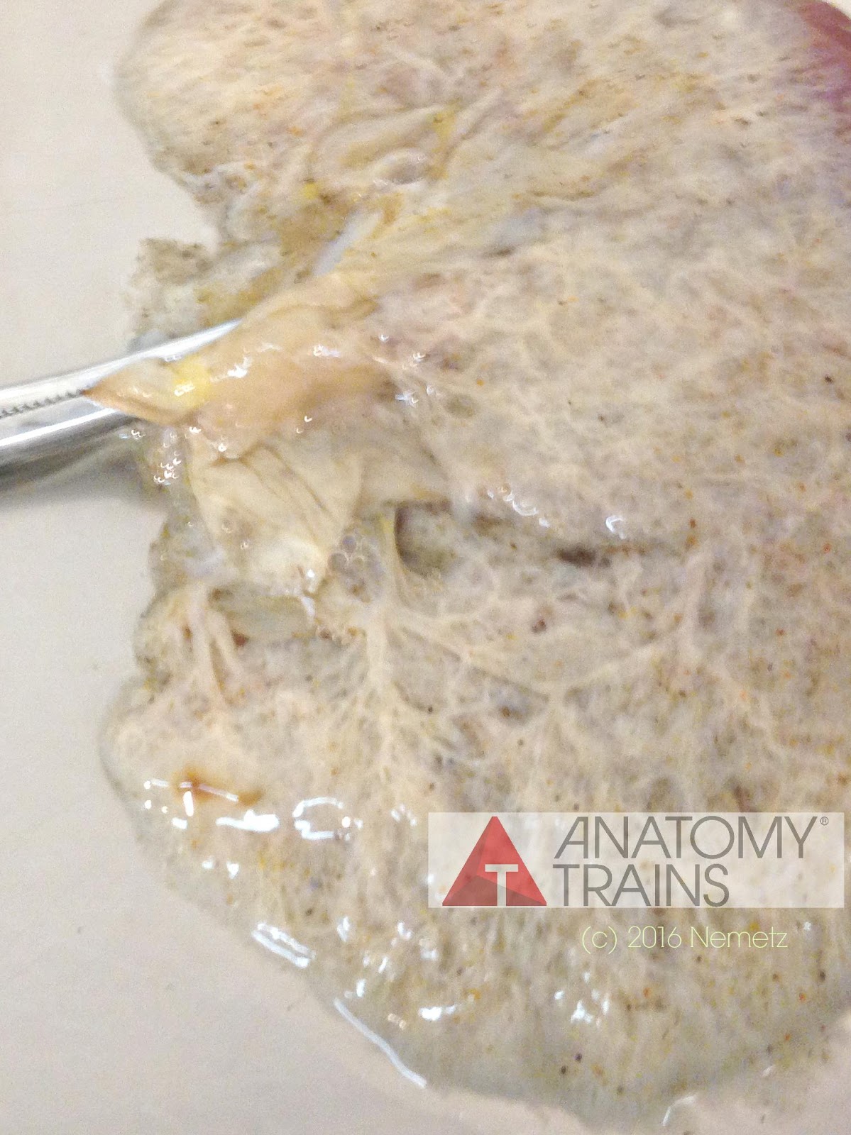 Creating Fascial Organ Models | Seeing Fascial Web