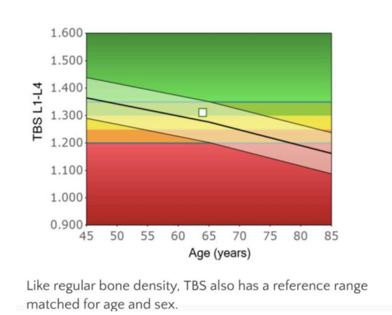 Understanding Trabecular Bone Score When Diagnosing Osteoporosis